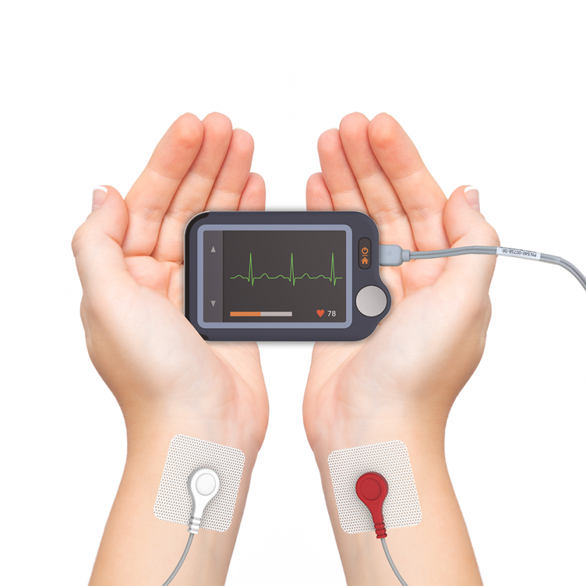 Personal ECG Monitor | Surgical Supplies | Medical Devices NZ