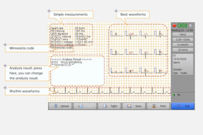 Biocare iE300 Digital Electrocardiograph | Surgical Supplies | Medical ...
