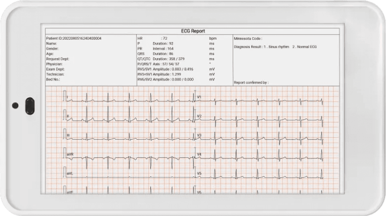 12-Lead Pocket ECG Machine | Surgical Supplies | Medical Devices NZ